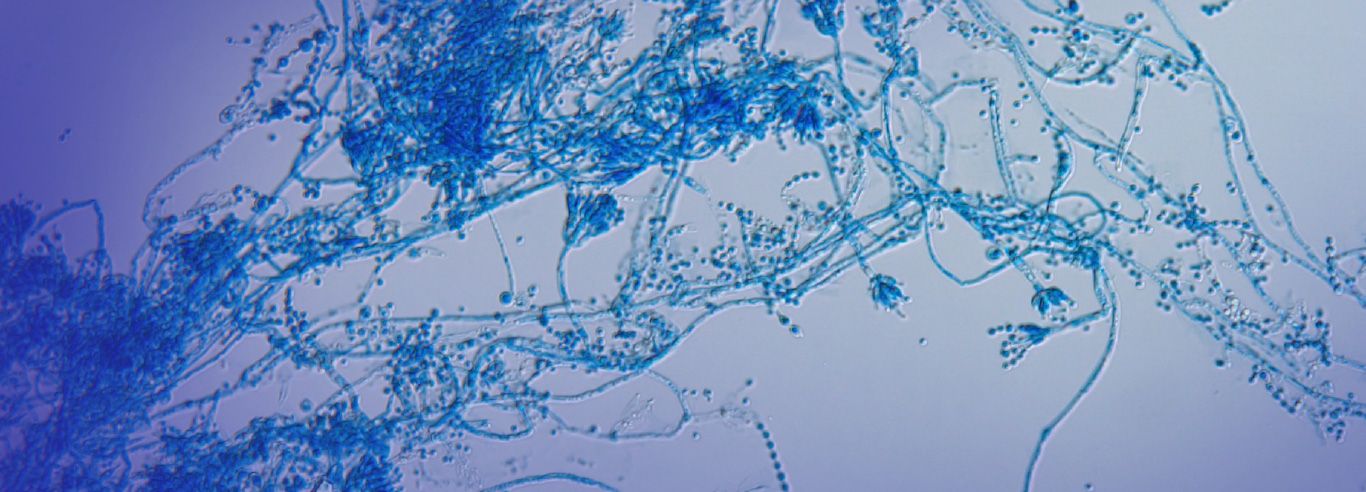 Management of cryptococcosis and talaromycosis | The AFWG
